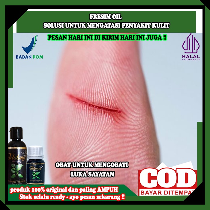 Jual Obat Luka Sayatan, Obat Oles Pengering Luka Sayatan, Luka Sayatan ...