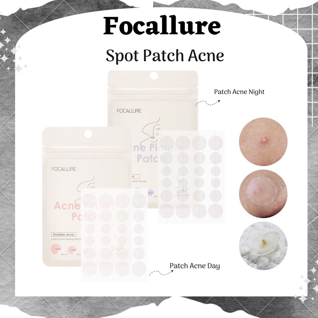 Jual Focallure Spot Acne Patch Treatment Day/Night Waterproof Smooth ...