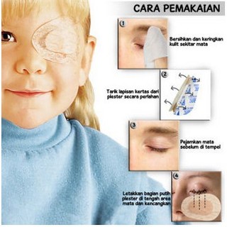 Jual 1PCS Nexcare Optikclude Eyepatch lazy eyes patch penutup mata ...