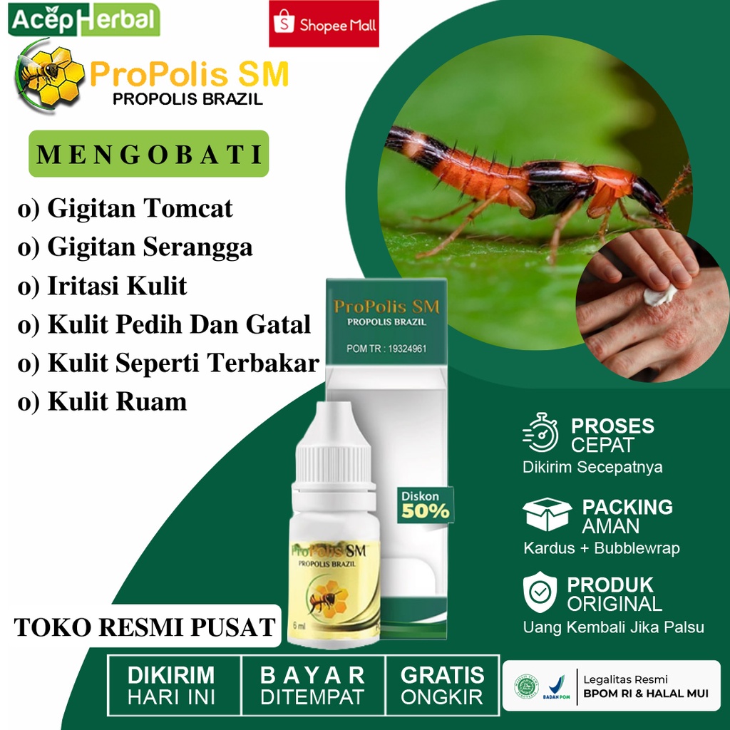 Jual Obat Gigitan Tomcat Gigitan Serangga Kulit Ruam Iritasi Kulit ...