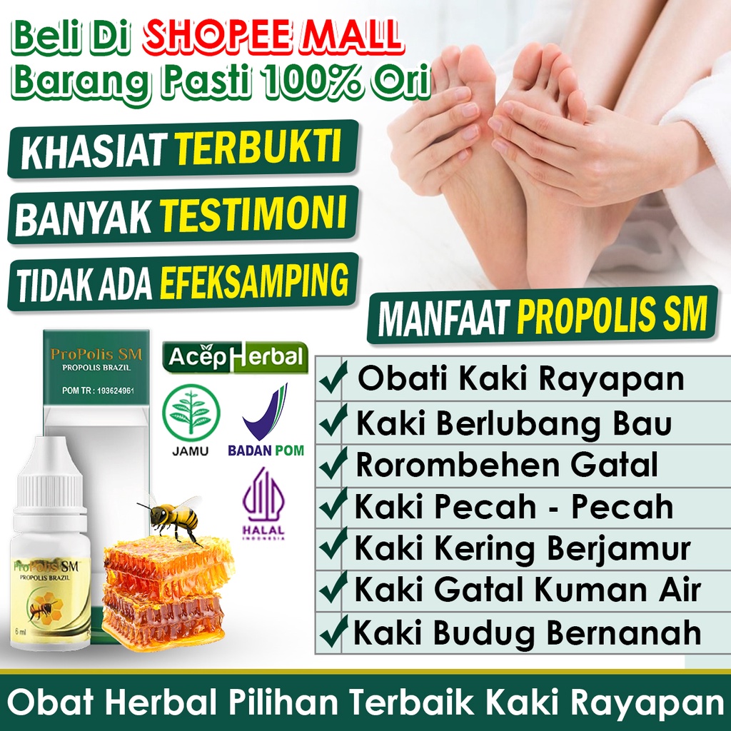 Jual Obat Kaki Rayapan dan Bau Berlubang Telapak Kaki Bolong Bolong ...