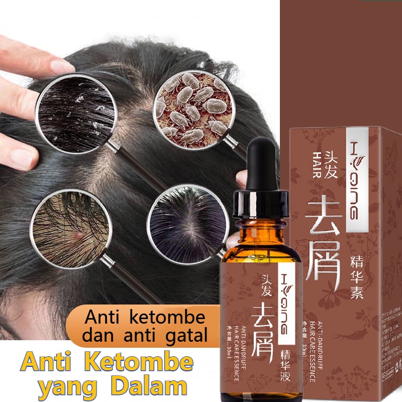 Jual obat ketombe kepala gatal ampuh serum ketombe dan gatal ampuh Serum anti ketombe shampoo ...