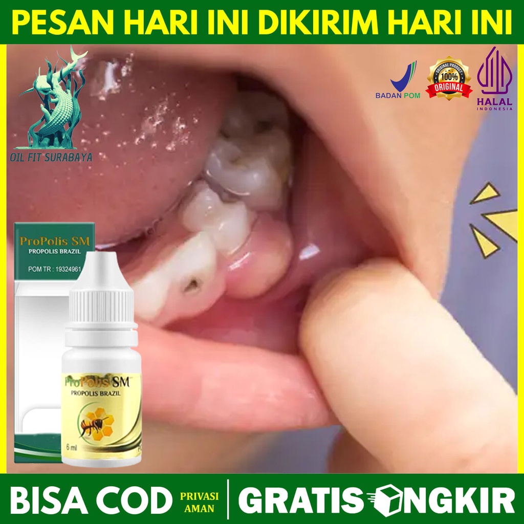 Jual Cara Mengatasi Gusi Bengkak Gusi Bengkak Bernanah Gusi Bengkak ...