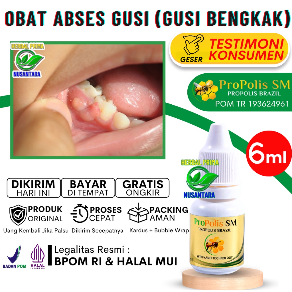 Jual Obat Tetes Abses Gusi - Obat Gusi Bernanah Radang Dan Nyeri Gusi ...