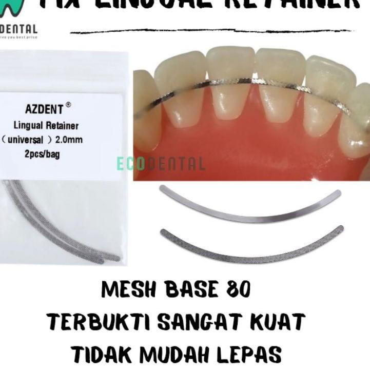 Jual New Trend Dental Lingual Retainers 1.2mm dan 2mm Mesh Base Fix ...