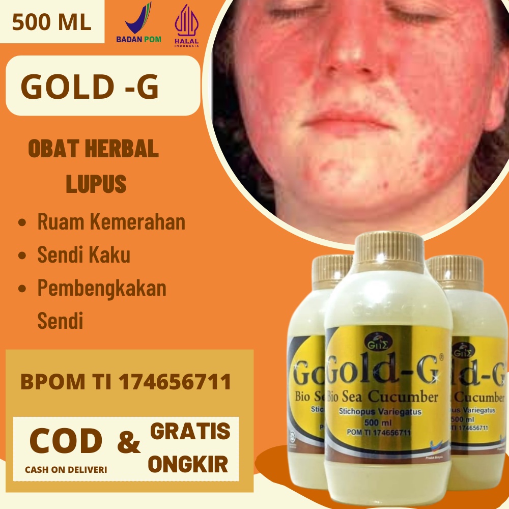 Jual Obat Oles Penyakit Lupus Autoimun,Ruam Di Kulit,Ruam Kemerahan Di ...