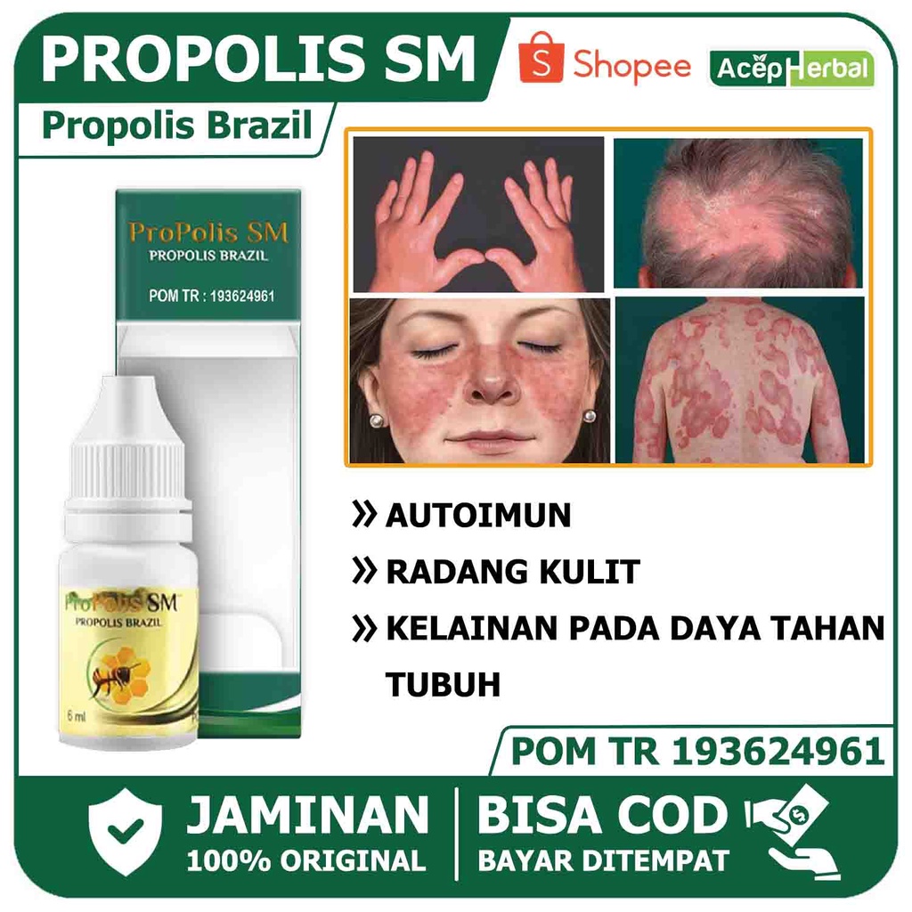 Jual Obat autoimun lupus psoriasis kelainan daya tahan tubuh mengatasi ...