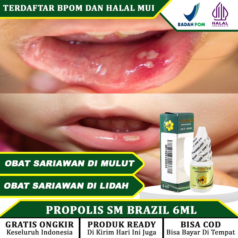 Jual Propolis Asli Original - Obat Perih Sariawan - Obat Tetes Sariawan ... Jual Propolis Asli Original - Obat Perih Sariawan - Obat Tetes Sariawan ...