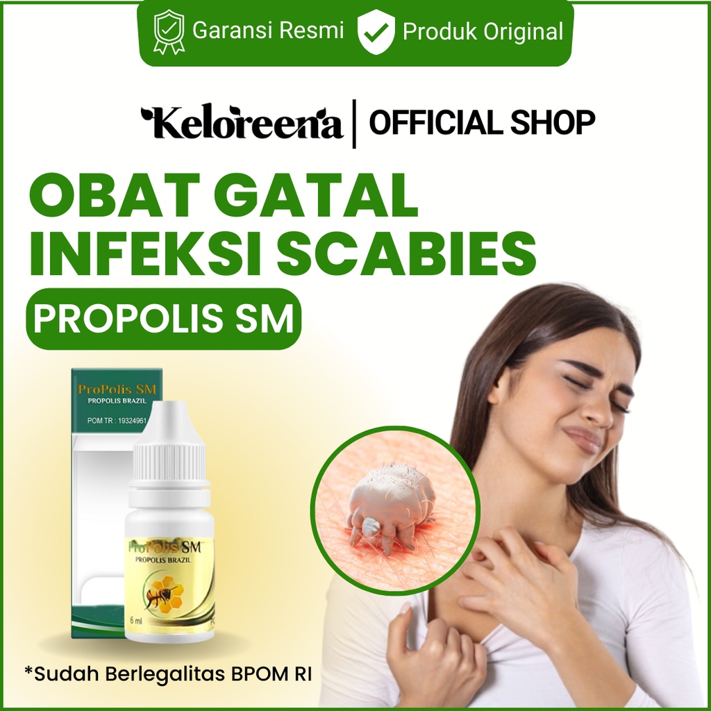 Jual Obat Sekabies Oles Scabies Manusia Skabies Tetes Gatal Budug Borok ...
