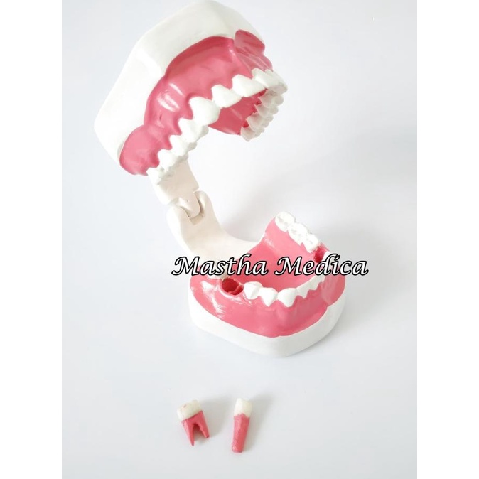 Jual Alat Peraga Simulasi Simulator Manekin Model Gigi Dental Fiber ...