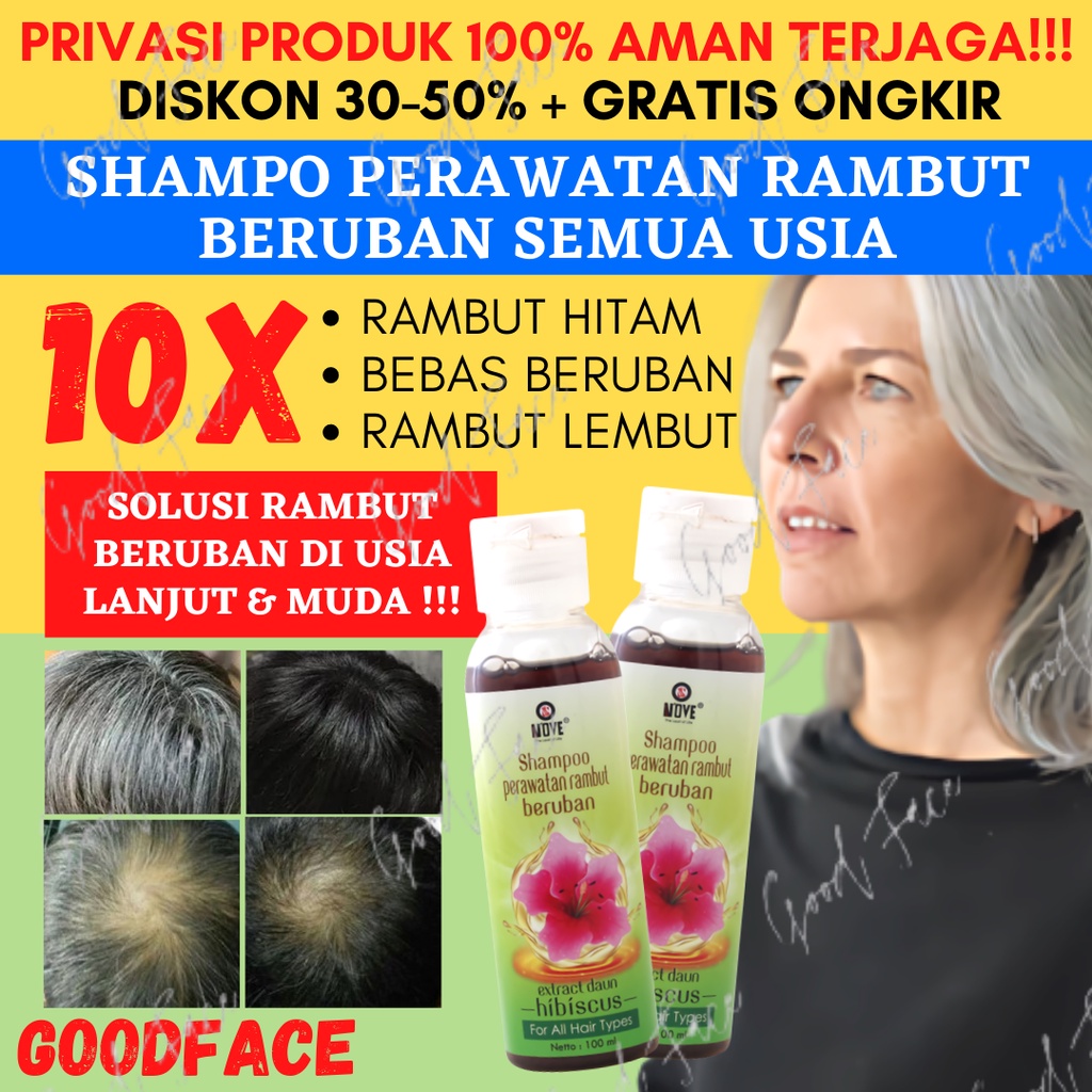 Jual NOVE SHAMPOO PERAWATAN RAMBUT UBAN 100ML SHAMPO ANTI UBAN NOVE ...