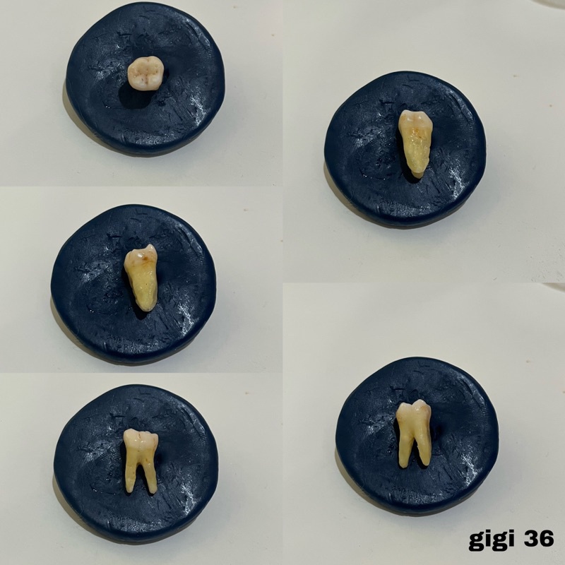 Jual Gigi Molar 1 2 3 bawah (gigi 36 37 38 46 47 48) graham praktikum ...