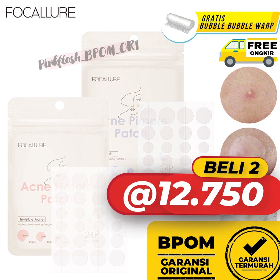 Jual Harga Termurah FOCALLURE Acne Patch Spot Patch Focallure Pimple Patch Acne Treatment Day ...