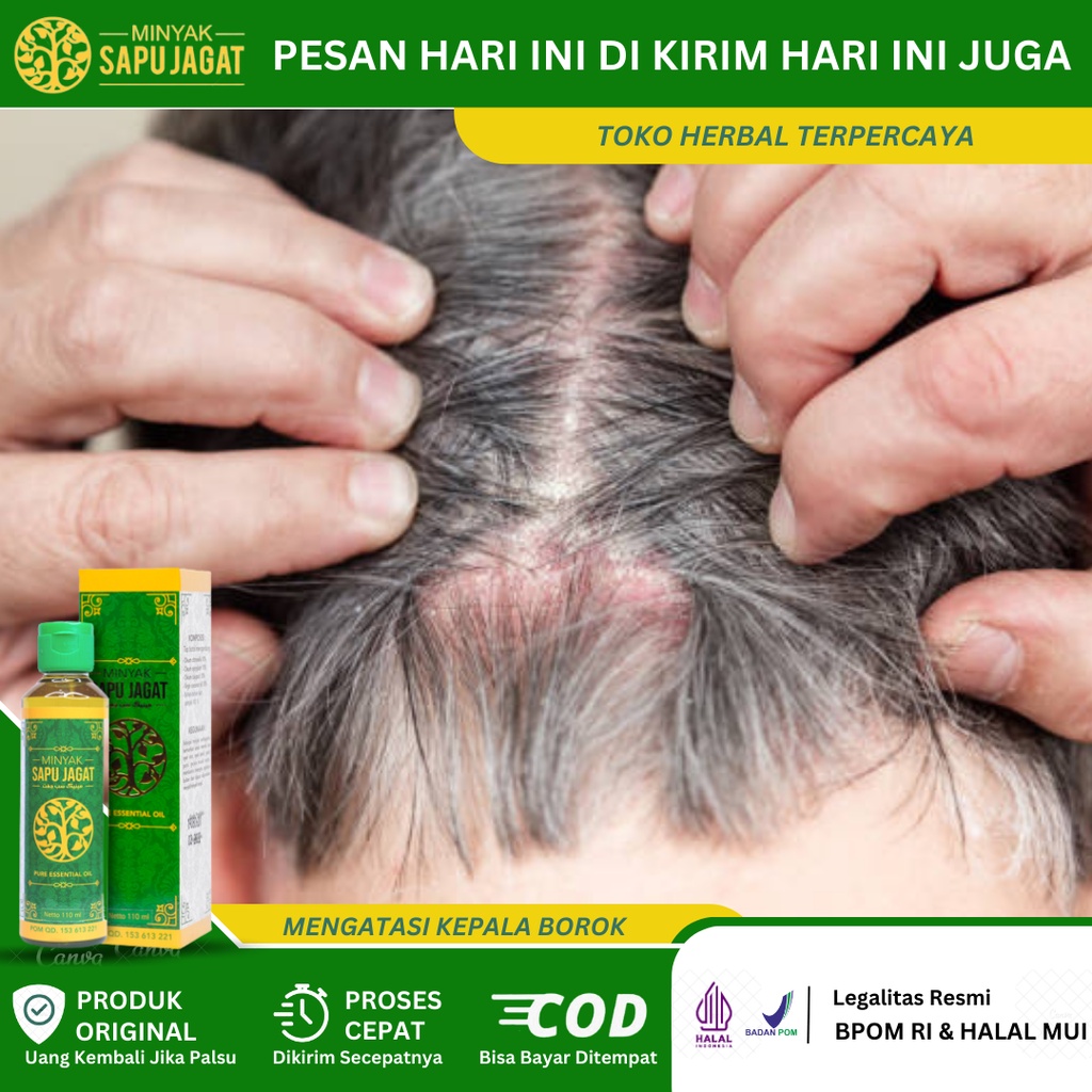 Jual Obat Kulit Kepala Borok, Obat Jamur Kulit Kepala, Obat Kepala Bersisik, Obat Kurap Di Kulit ...