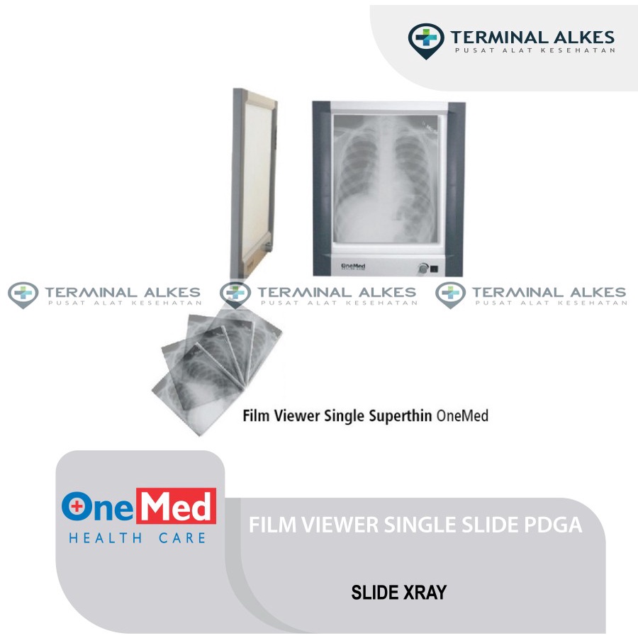 Jual FILM VIEWER SINGLE OneMed X-Ray /SINGLE SLIDE ONEMED | Shopee ...