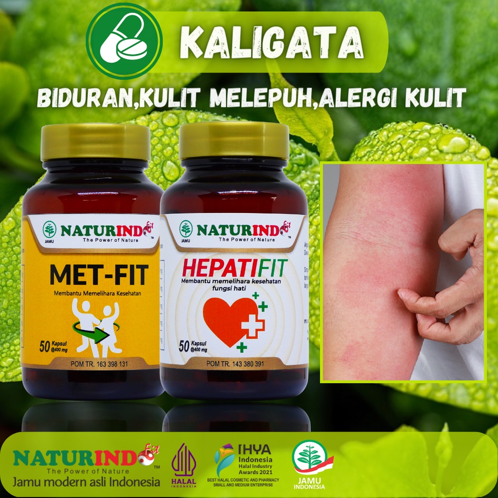 Jual Obat biduran kaligata alergi dingin kulit melepuh gatal bintik ...