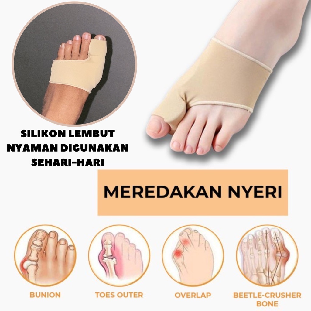 Jual Alat Terapi Sleeve Korektor Tulang Jempol Bunion Corrector Anti Jari Kaki Bengkok Hallux ...