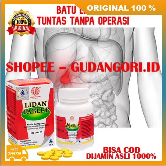 Jual Lidan Tablet Ramuan Herbal Tradisional Cina Ampuh Atasi Batu ...