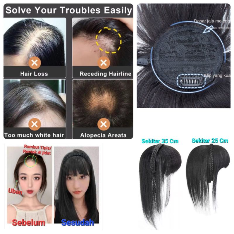 Jual WIG TOUPEE PENUTUP UBAN BOTAK BANDO 3D PENAMBAH VOLUME RAMBUT ...