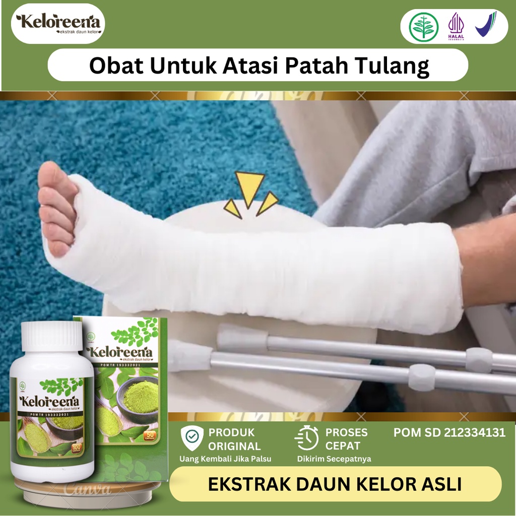 Jual Obat Patah Tulang, Obat Cedera Tulang, Obat Tulang Bergeser, Obat ...