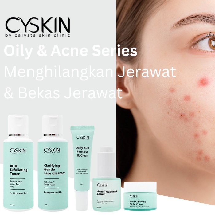 Jual Paket Join Calysta Acne Care Pontianak | Shopee Indonesia