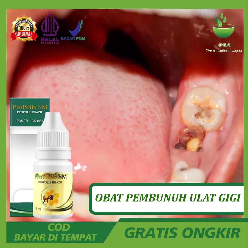 Jual Obat Untuk Membunuh Ulat Gigi Ngilangin Ulat Gigi Pengobatan ...