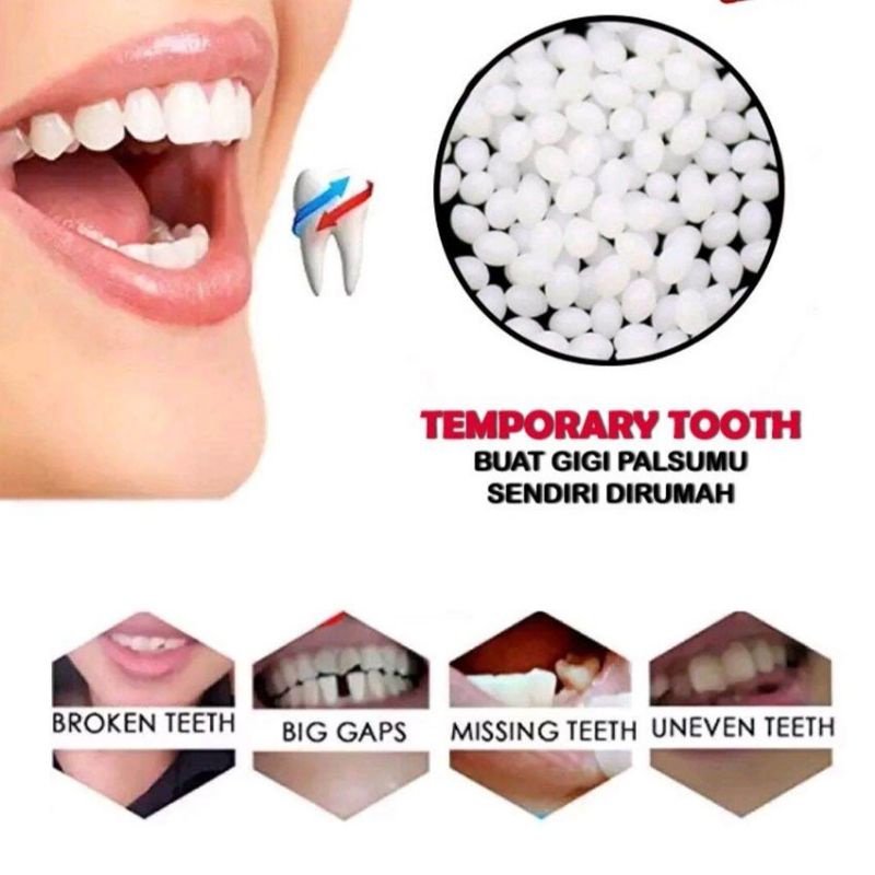 Jual GIGI PALSU SEMENTARA 100 BUTIR / PENAMBAL GIGI PATAH RENGGANG ...