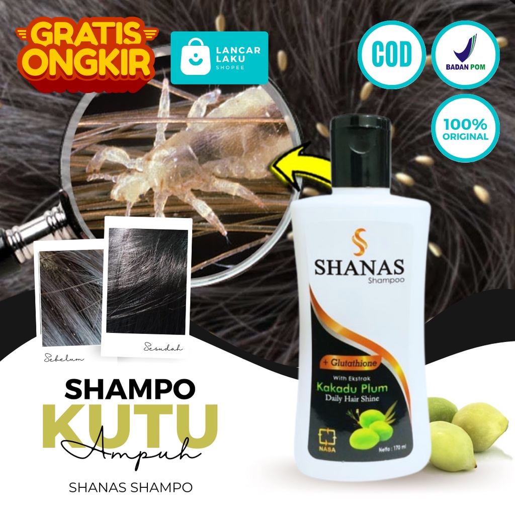 Jual SAMPO SANAS SHAMPO SHANAS OBAT KUTU RAMBUT AMPUH DAN TELUR KUTU ...