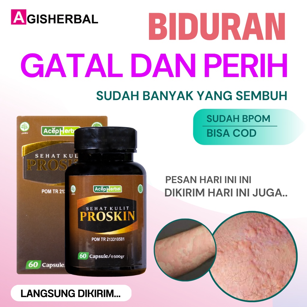 Jual Obat Biduran Alergi 100% Original - Proskin Sehat Kulit Atasi ...