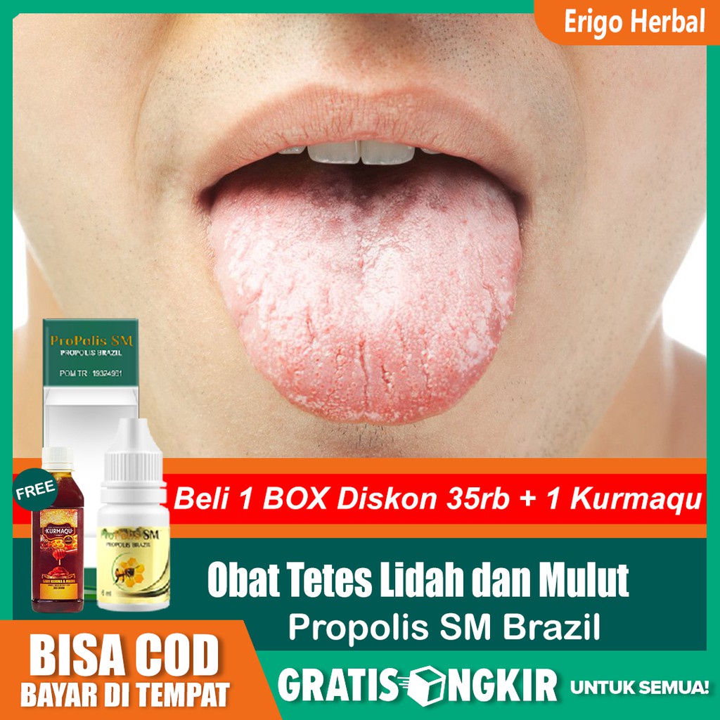 Jual Obat Mulut Bau Busuk, Tetes Lidah Putih, Terasa Pahit, Halitosis ...