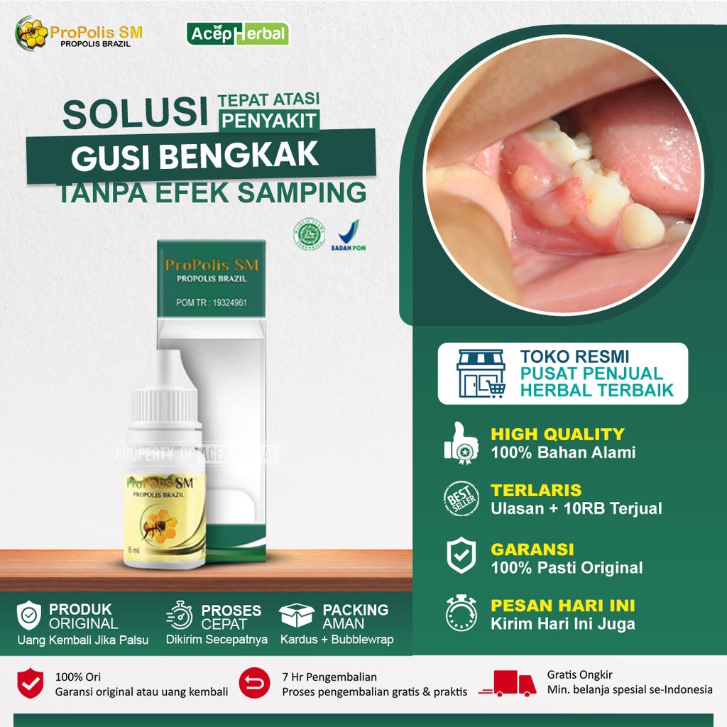 Jual Obat Gusi Bengkak Radang Gusi Perikoronitis Gusi Berdarah Infeksi ...