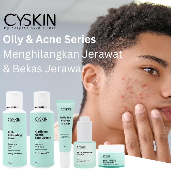 Jual Paket Acne Calysta Cream Muka Berjerawat Merah Calysta Skin Clinic ...
