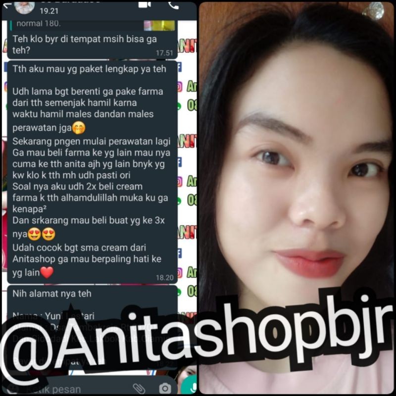 Jual REAL TESTIMONI PEMAKAIAN CREAM FRM ANITA | Shopee Indonesia