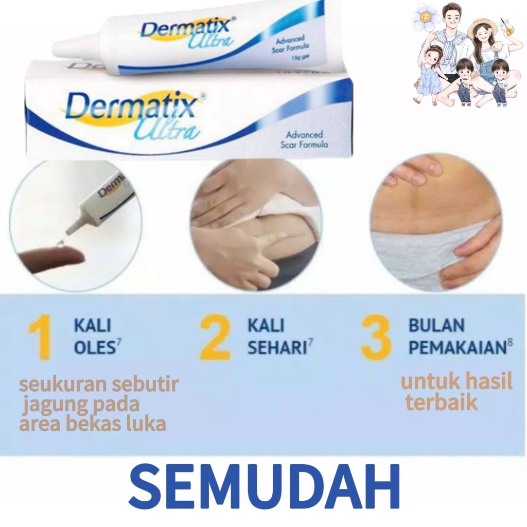 Jual Dermatix Ultra Cream 15gr Penghilang Bekas Luka Operasi Keloid ...