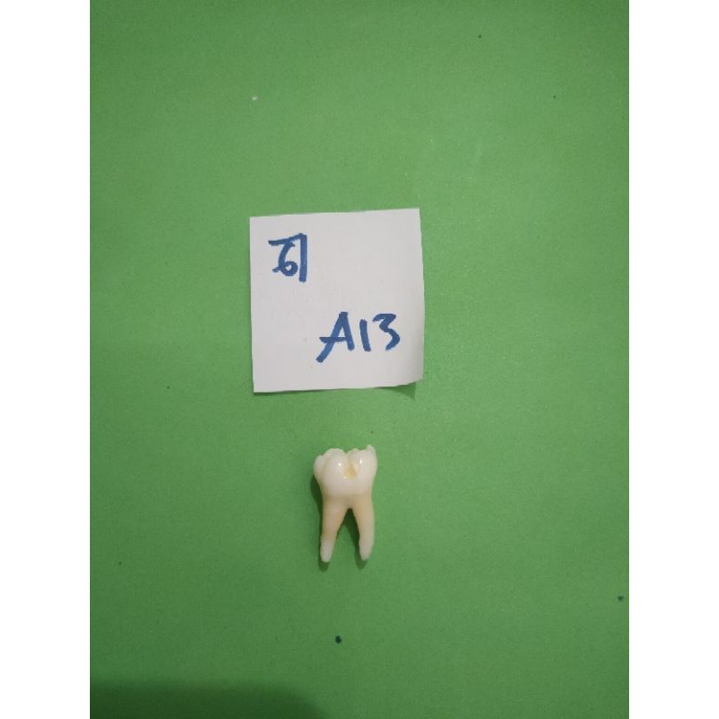 Jual Gigi 46 A13 Gigi Molar 1 Kanan Bawah | Shopee Indonesia