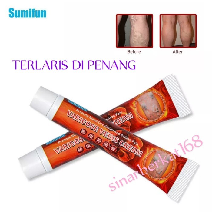 Jual Sale Krim Herbal Penghilang Varises Parises Otot Urat Menonjol ...