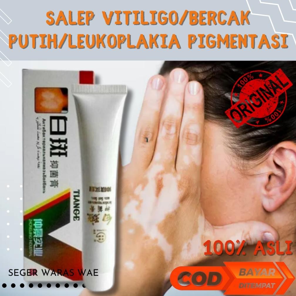 Jual SALEP VITILIGO BERCAK PUTIH / KULIT BELANG / PANU SALEP PANU ...