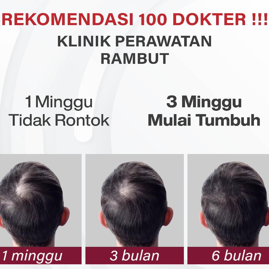 Jual Bioxsine Shampoo Anti Botak, Umbuh Rambut, Atasi Kerontokan Dan ...