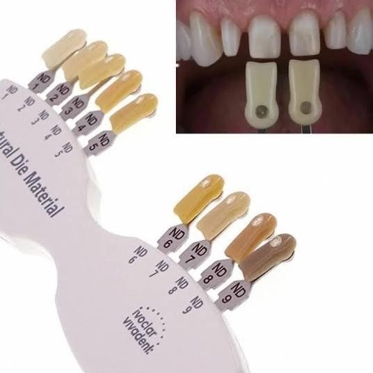 Jual Dental shade guide ND porcelain Natural Die material IPS ivoclar ...