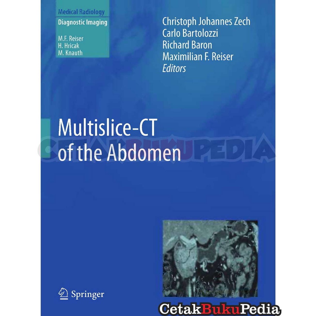 Jual Book Multislice CT of Abdomen | Shopee Indonesia
