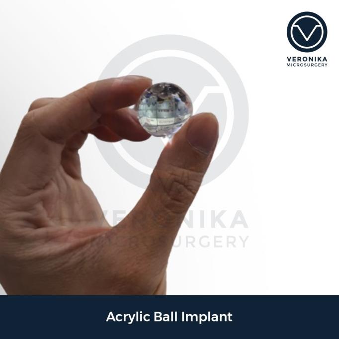 Jual Terbaik Acrylic Ball Implant / Implan Akrilik Bola Mata Limited ...