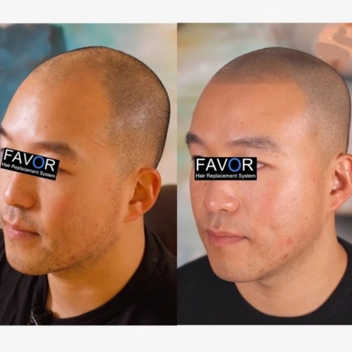 Jual Bay- Botak Smp Hair Tattoo Wig Toupee Scalp Micro Pigmentation ...