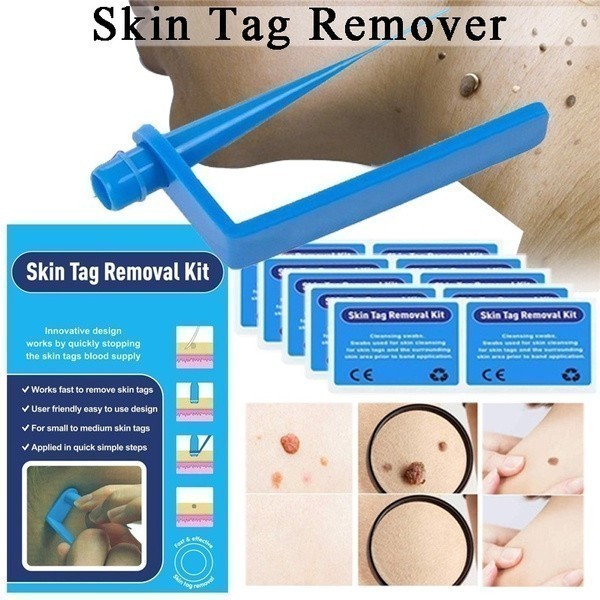 Jual Auto Micro Skin Tag Remover Original Epm | Shopee Indonesia
