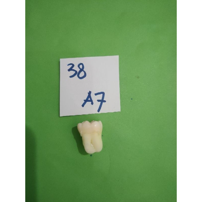 Jual Gigi 38 A7 Gigi Molar 3 Kiri Bawah | Shopee Indonesia