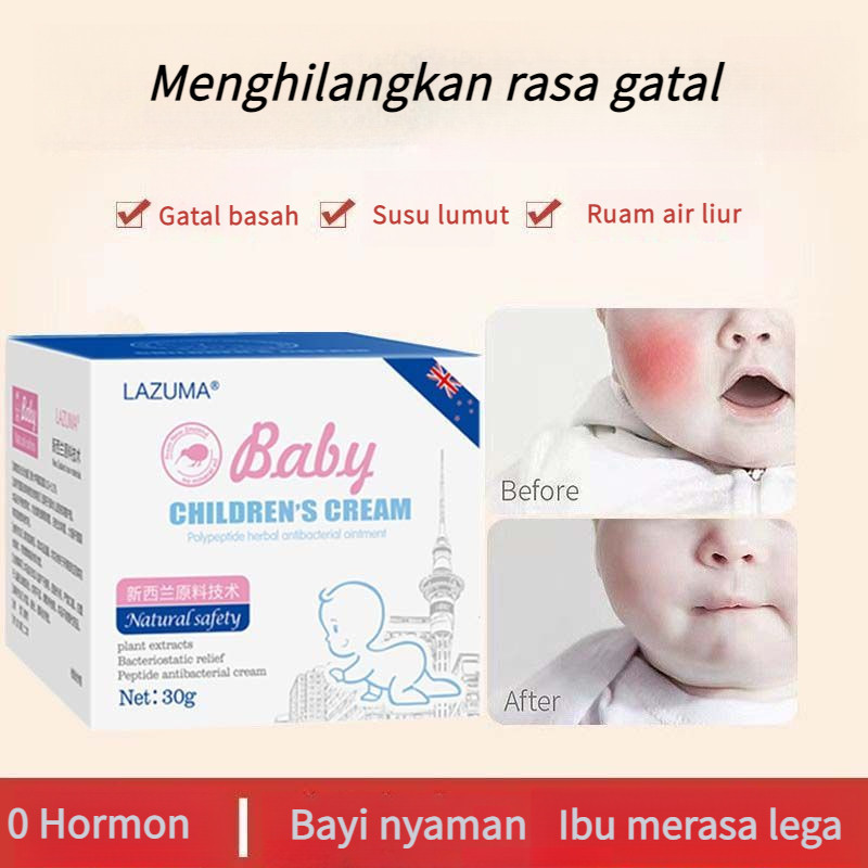 Jual Infant eczema specific hormone-free Drooling rash Milk moss ...