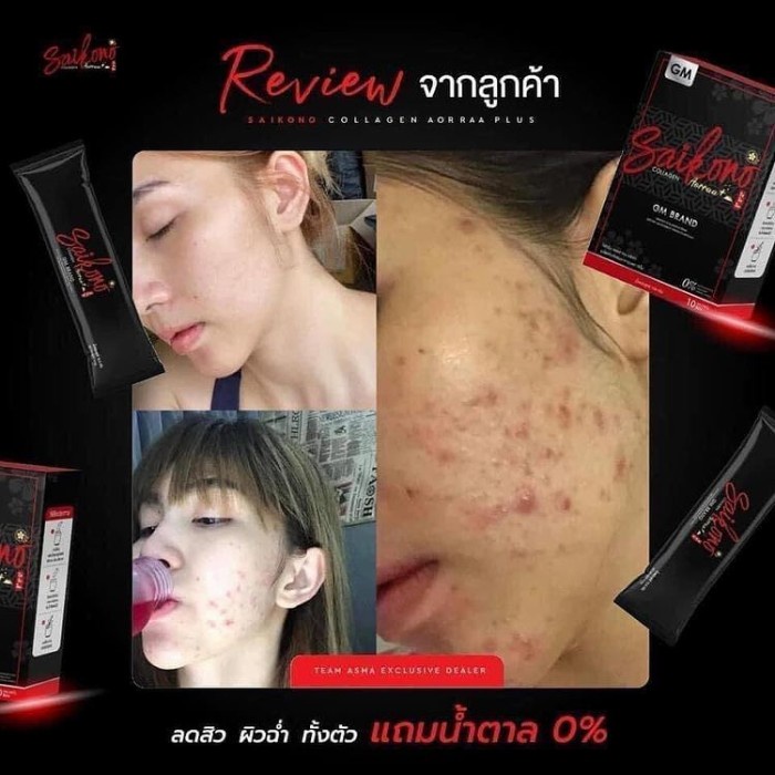 Jual SAIKONO COLLAGEN Drink ORIGINAL GM THAILAND COLLA MELODY GLUTERA ...