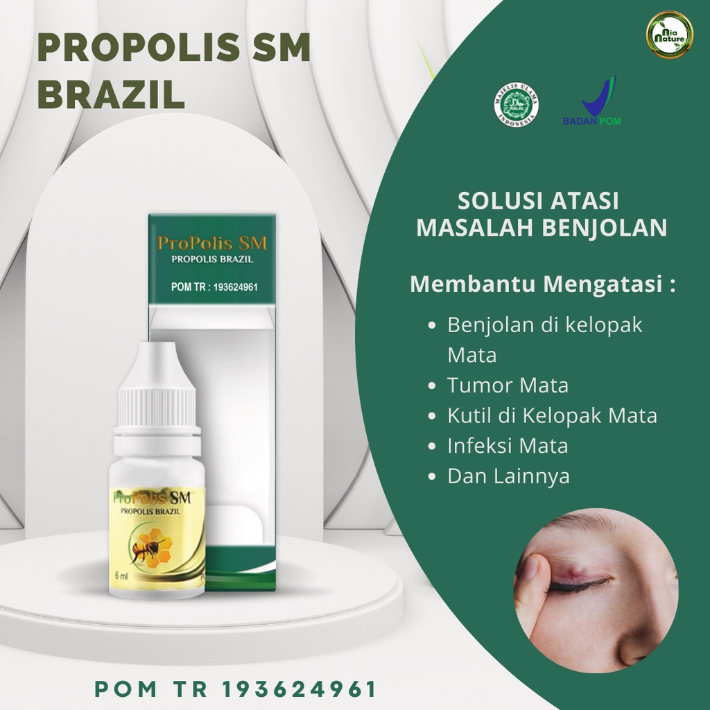 Jual Obat Penghilang Benjolan di Kelopak Mata - Propolis SM – BPOM ...