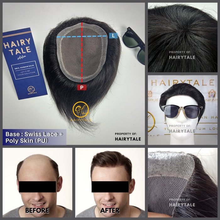 Jual Bay- Toupee/Tutup Botak Pria Human Hair, Swiss Lace+Poly Skin(Pu ...