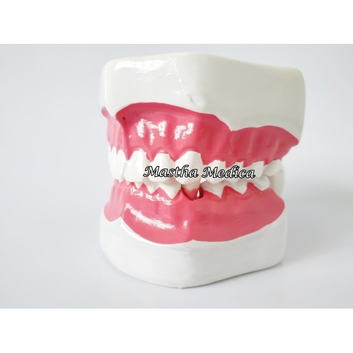 Jual Alat Peraga Simulasi Simulator Manekin Model Gigi Dental Fiber ...