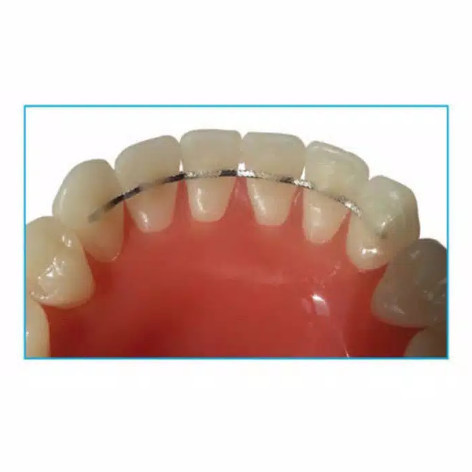 Jual LINGUAL RETAINER FDA / KAWAT GIGI RETAINER CEKAT / ORTHO ...